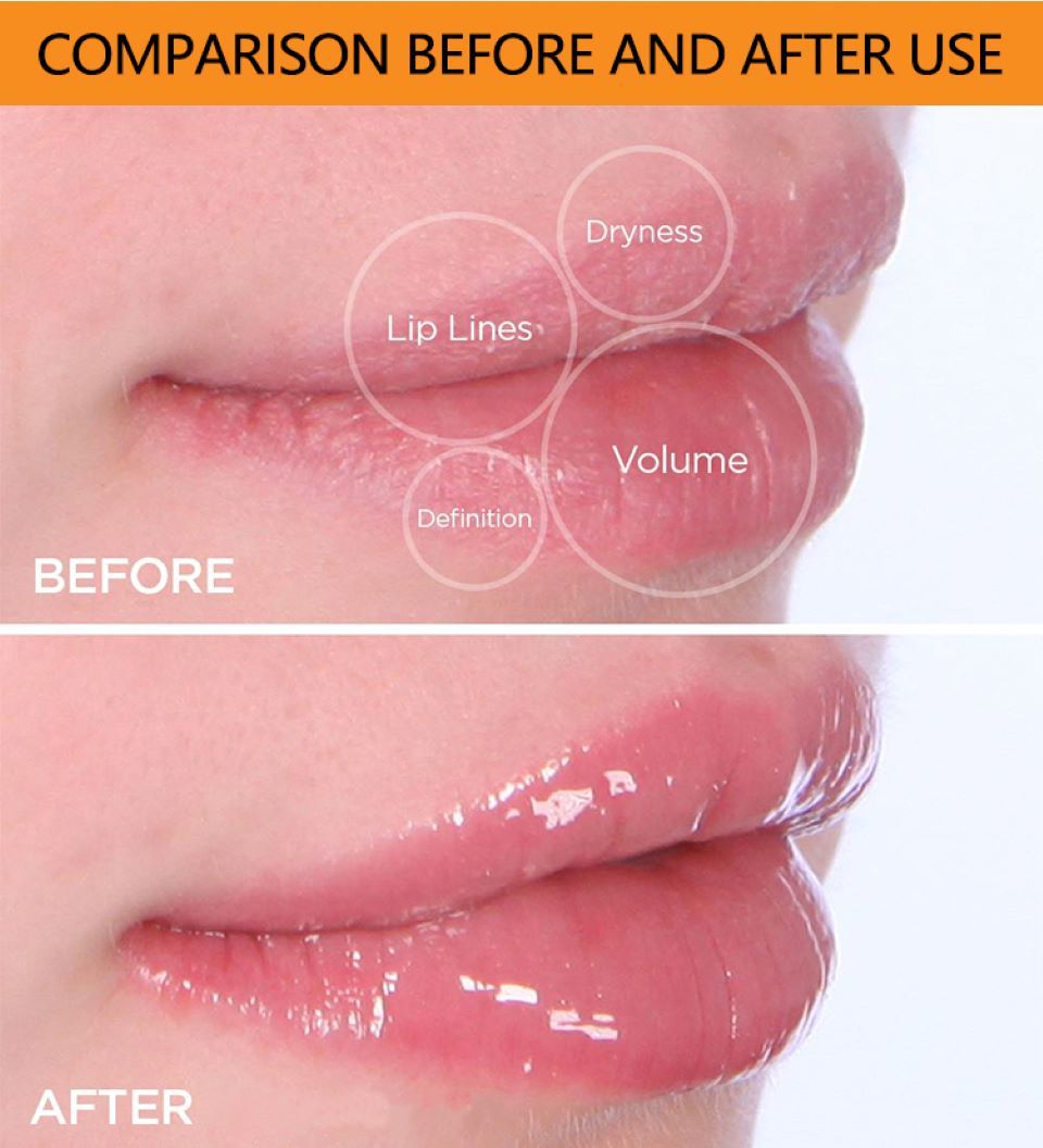 Buy Wholesale China Wholesale Best Lips Fuller Absorb Roller Lip Device ...