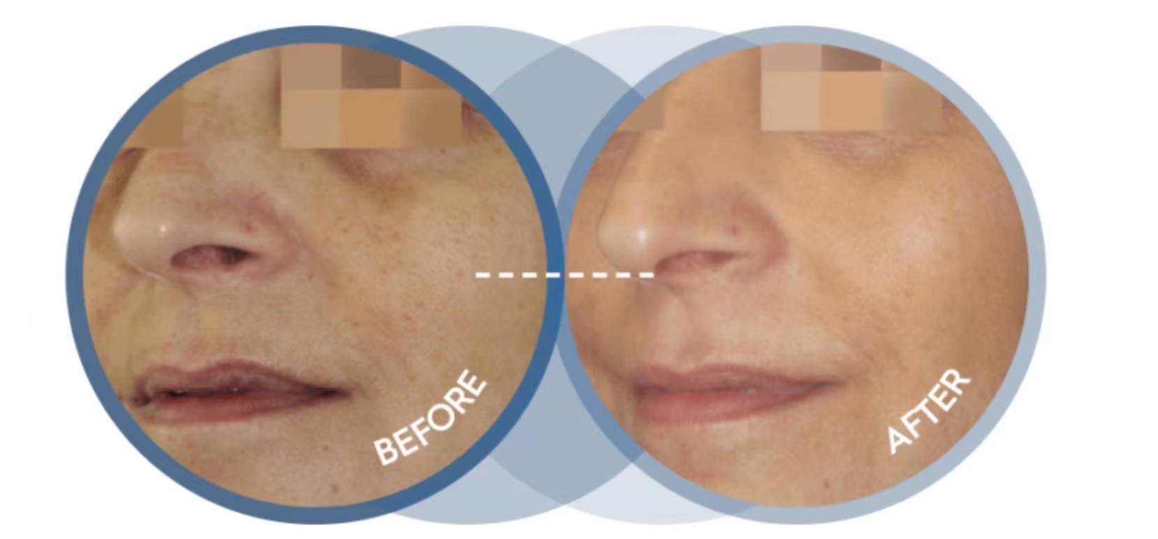 Buy Wholesale China Famous Original Genuine Spain Mesoestetic Cosmelan ...