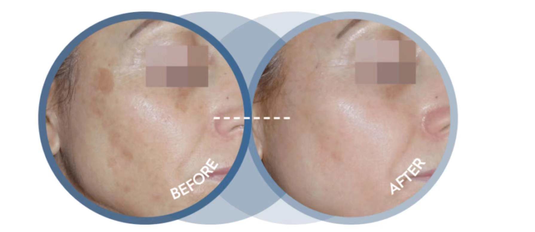 Buy Wholesale China Famous Original Genuine Spain Mesoestetic Cosmelan ...