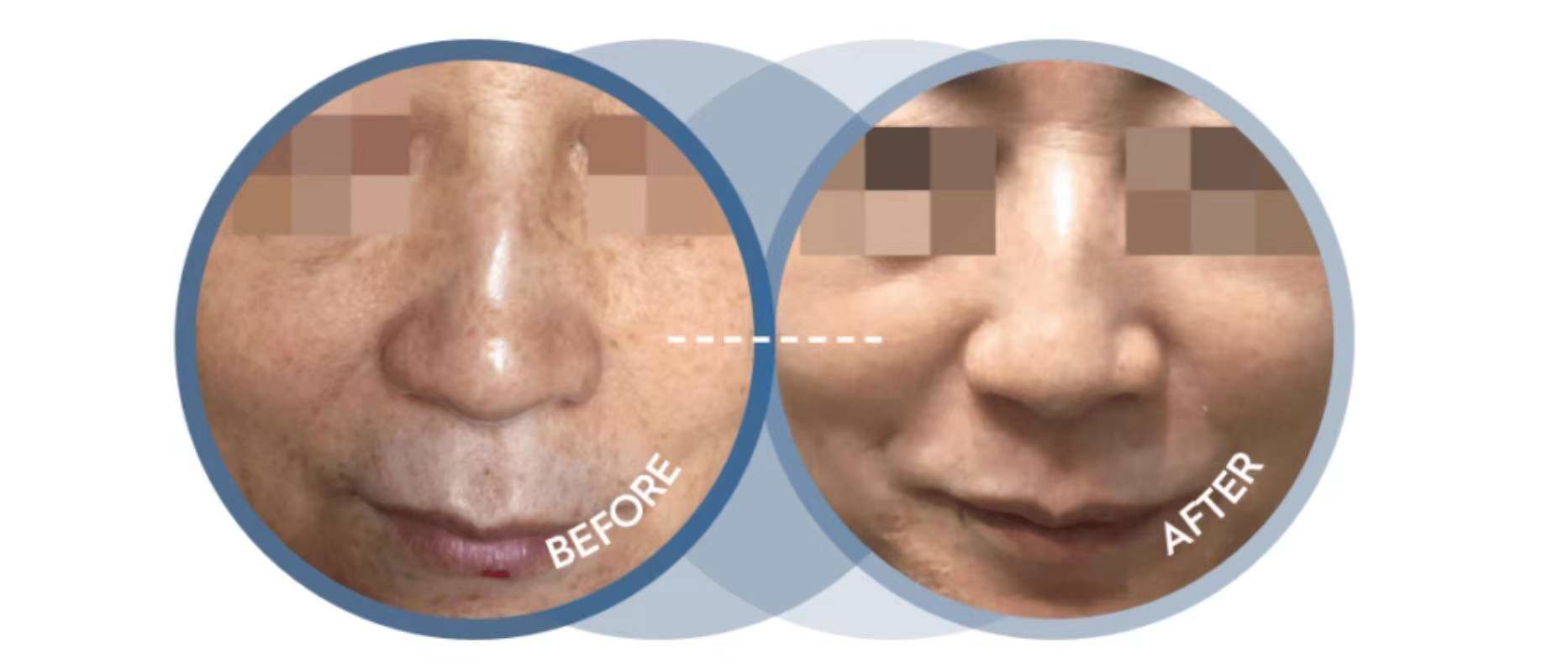 Buy Wholesale China Famous Original Genuine Spain Mesoestetic Cosmelan ...