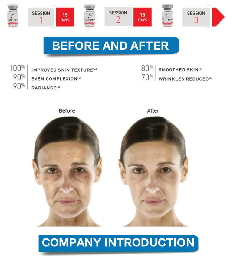 Buy Wholesale China Wholesale High Grade Fillmed Filorga Nctf 135 Ha ...