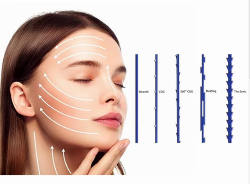 Buy China Wholesale Supplier Manufacturer Absorbable Face Pdo Thread ...