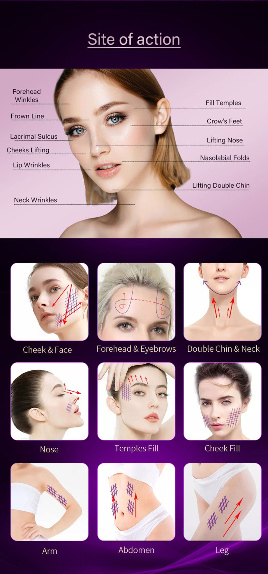 Buy Wholesale China Korea Absorbable Pcl Thread Lift Barbed Cog ...