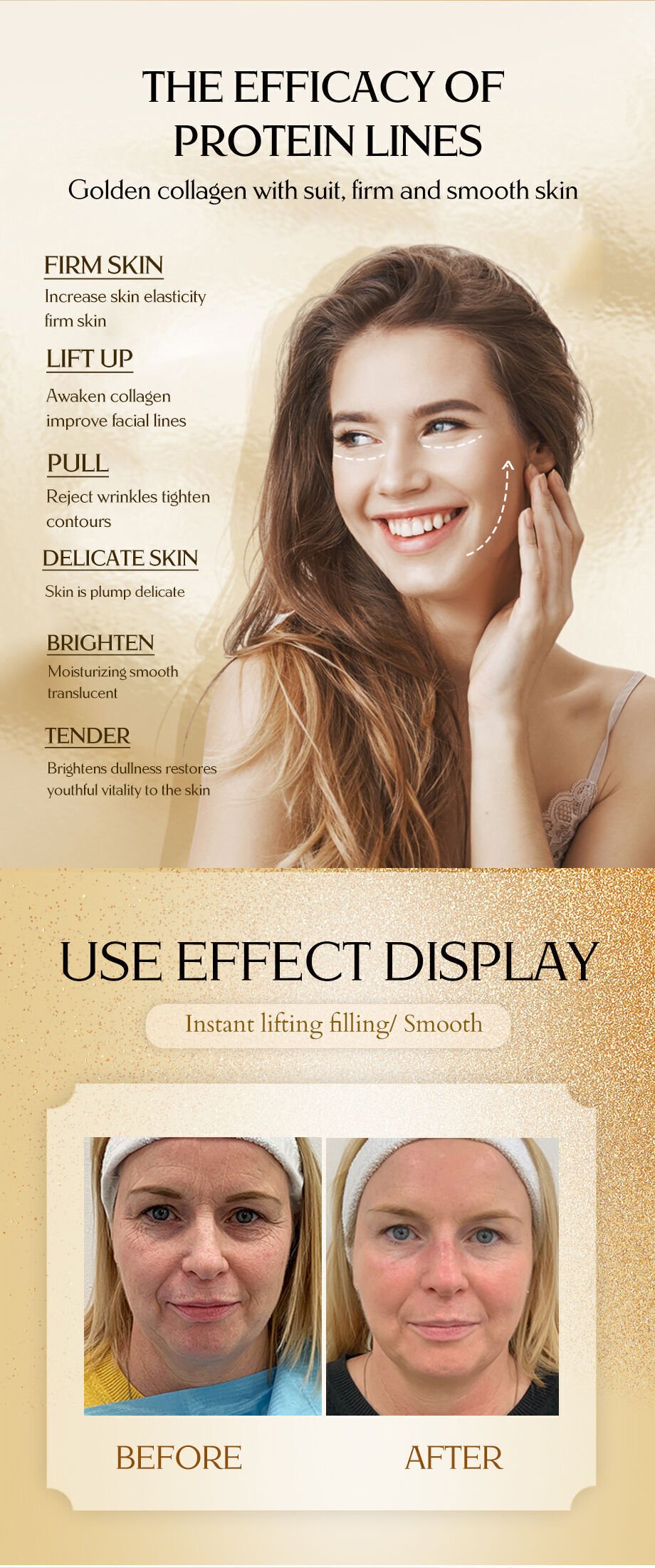 Collagen Thread Lift Facial Kit at Paul Morrison blog