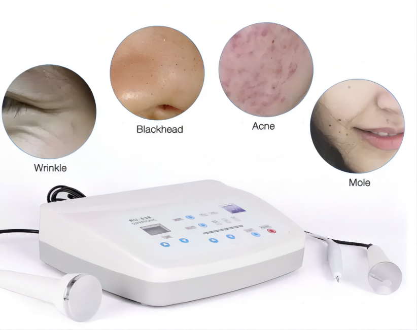 Buy Wholesale China 3 In 1 Ultrasonic Rf Facial Massage Plasma Pen For ...