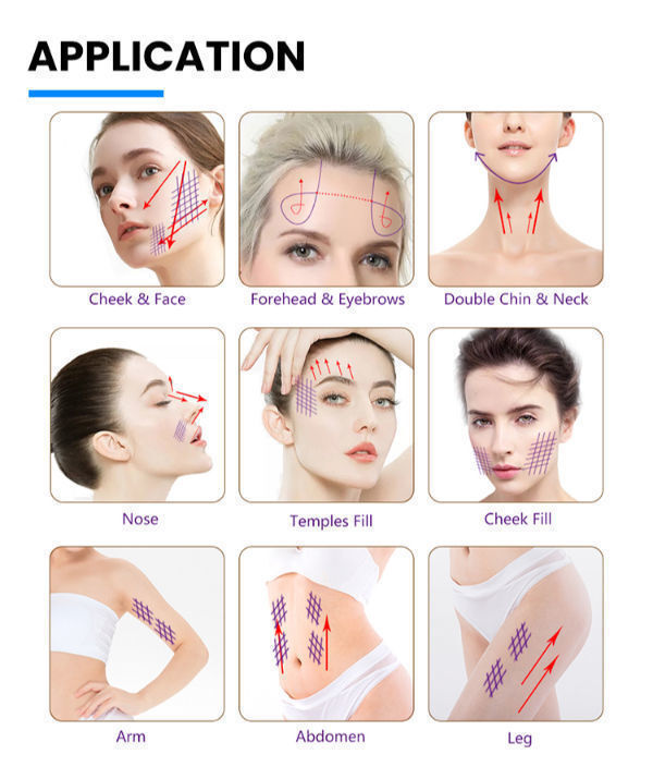 Buy Wholesale China 60mm Pdo Thread Lifting Mono Ce I Pdo Thread For ...