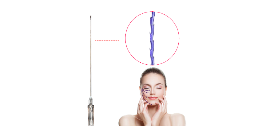 Buy Wholesale China Strong Face Lifting Pdo Molding Cog 18g 100mm Hilos ...