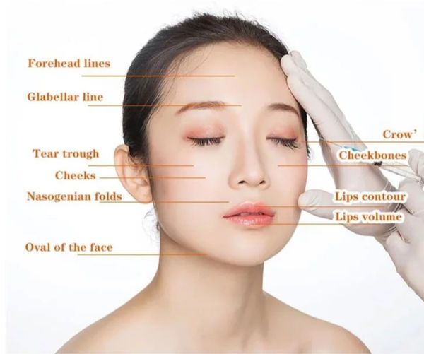 Buy Wholesale China Sculp Tra Plla Poly-l-lactic Acid Sculp Tra Vials ...