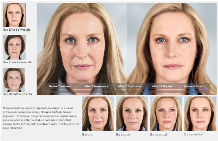 Buy Wholesale China Sculp Tra Plla Poly-l-lactic Acid Sculp Tra Vials ...