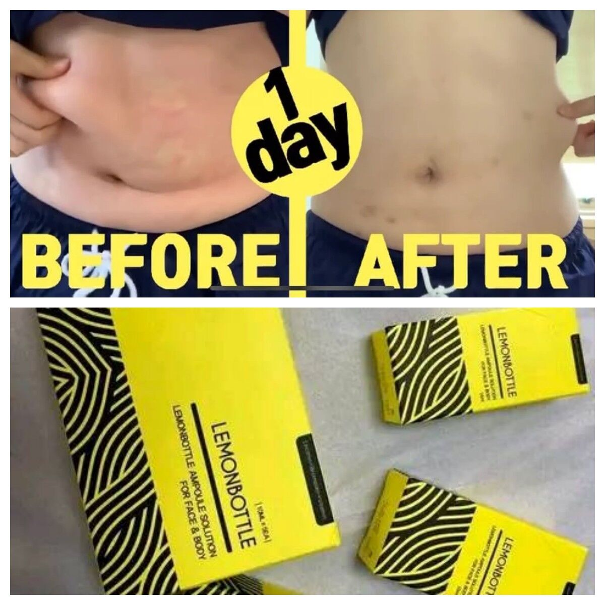 Buy Wholesale China Lemon Bottle - The Most Advanced Fat Dissolving ...