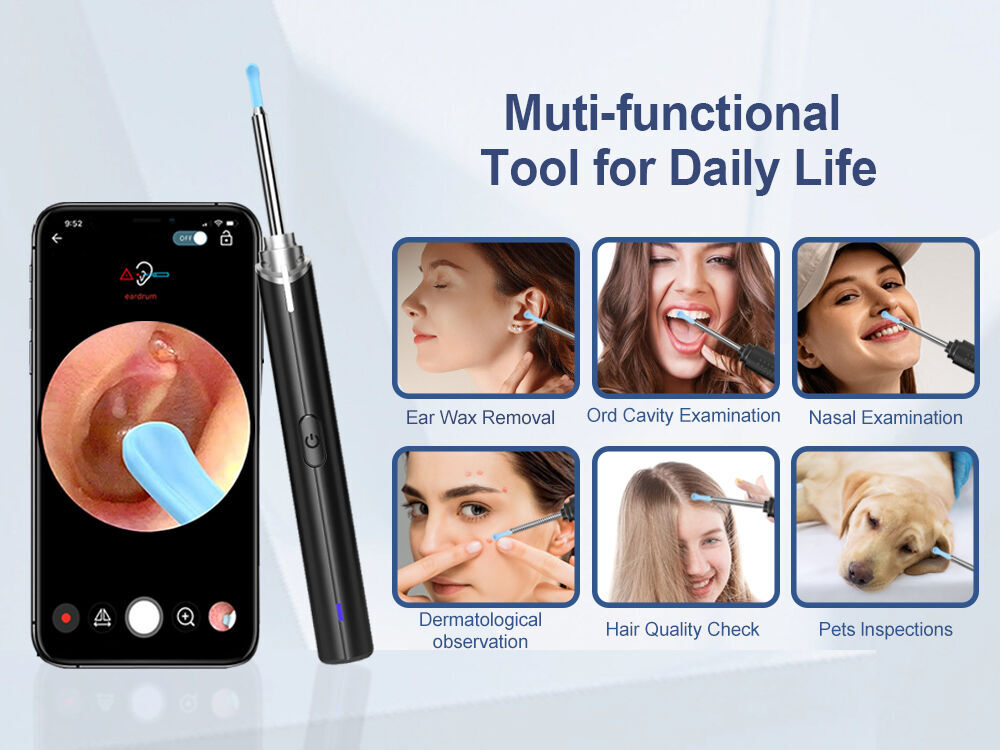 Buy Wholesale China Y13 Pro Ear Wax Removal Tool Of Factory Price (odm/oem) Ear Cleaning ...