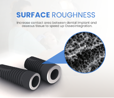 Wego Dental Implant Ce Iso Dental Fixture Manufacture S.l.a Surface ...