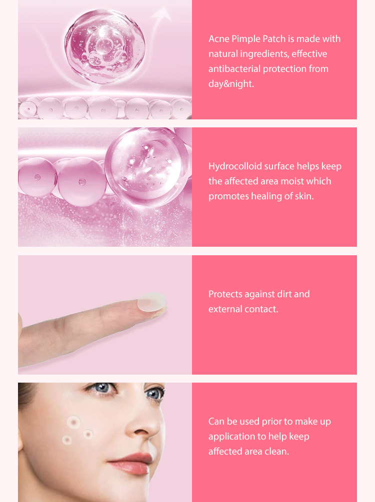 Buy Wholesale China Wholesale Various Shapes Acne Healing Pimple Master ...