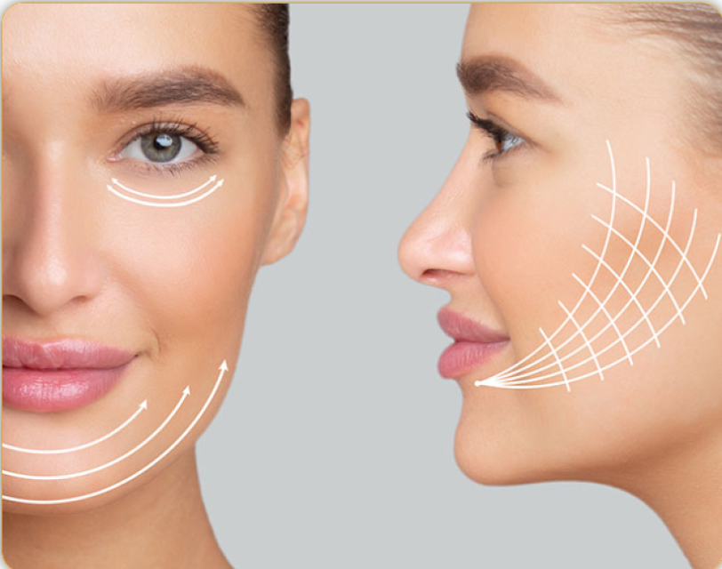 Buy Wholesale China Sterile Absorbable Lift Thread Body Tightening ...