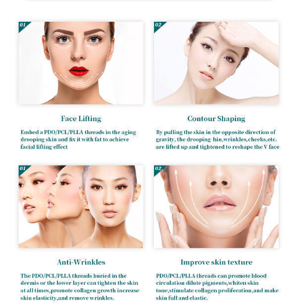 Buy Wholesale China Wholesale Pdo Threads Lift Eyes Face Neck Body Mono ...