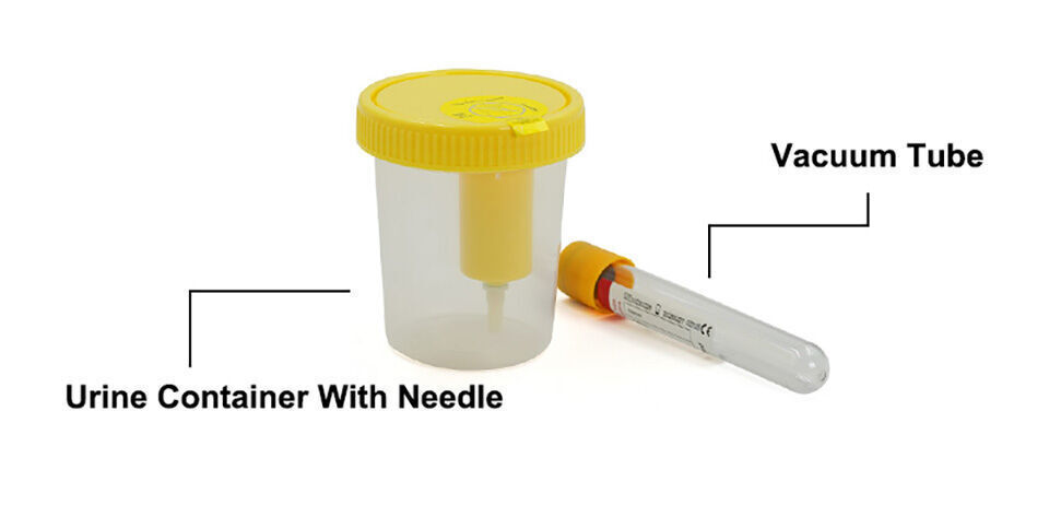 Buy Wholesale China Disposable Urine Container Urine Sample Cup Vacuum Urine Container With ...