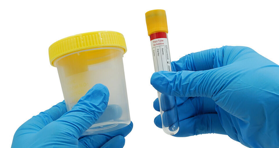 Buy Wholesale China Disposable Urine Container Urine Sample Cup Vacuum ...