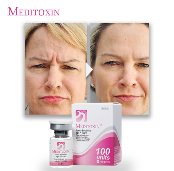 Buy Wholesale China 2023 Anti Wrinkle Products Re N Tox Wiztox Novatox ...