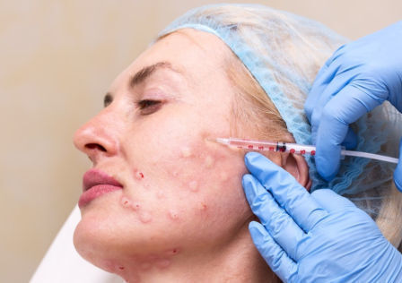 Buy Wholesale China 2023 Anti Wrinkle Products Re N Tox Wiztox Novatox ...