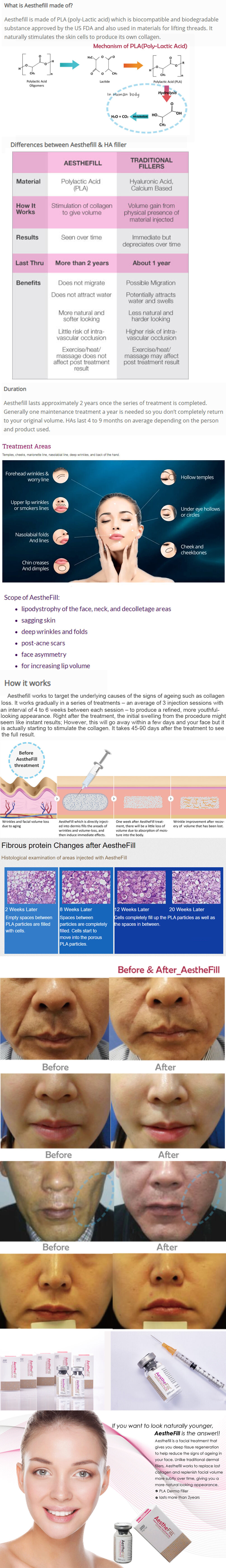 Buy Wholesale China Aesthefill 200mg/vial Korea Original Pla Filler ...