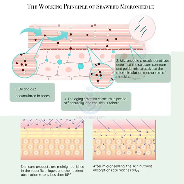 Microcrystalline Nasolabial Fold Removal Seaweed Sponge Spicule Bio ...
