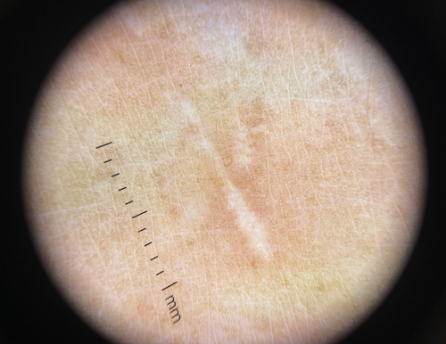 Bulk Buy China Wholesale Iboolo De-3100 Dermascopy 10x Magnify Macro ...