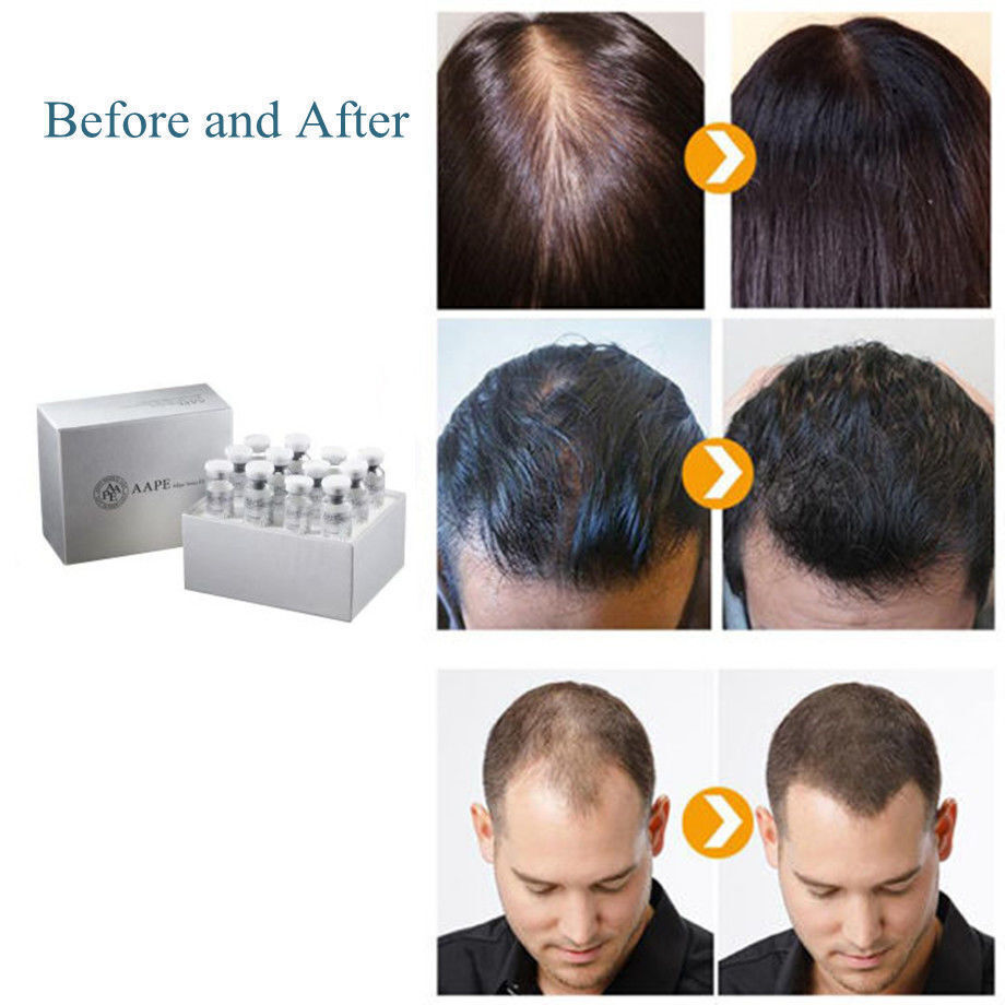 Buy Wholesale China Korea Aape Exosome For Hair Growth And Skin & Hair ...