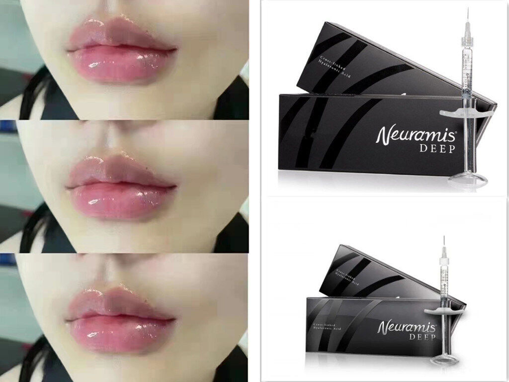Buy Wholesale China Wholesale The Red Fat Dissolving 3ml Lose Weight ...