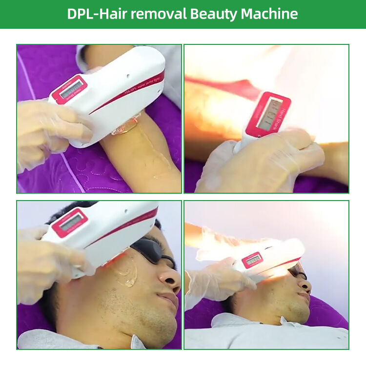 Buy Wholesale China Dpl Machine For Permanent Hair Remove,skin ...