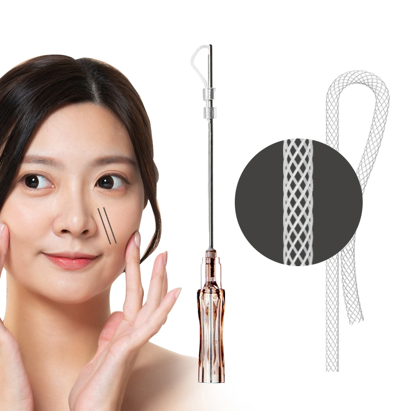 Minerva 18g*100mm Pcl Big V Line 20cps Cannula 4d Cog Thread Thread ...