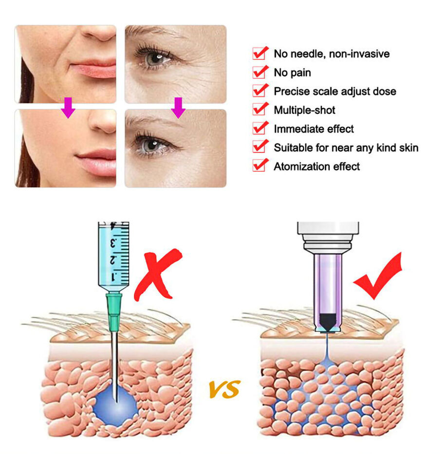 Buy Wholesale China Profesional Cross-linked Filler Ha Gold Black ...