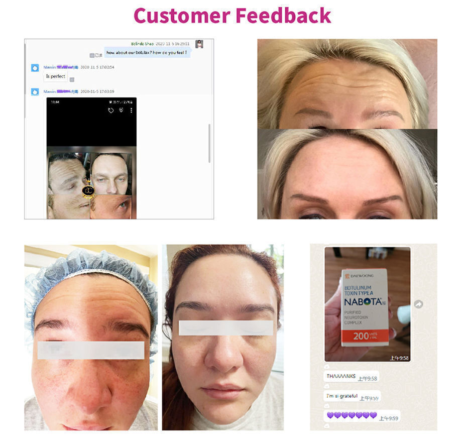 Buy Wholesale China Clinic New Botulinums Toxin Type A Injection 100ui ...