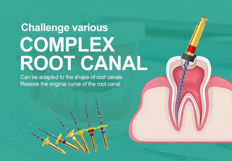 Rotary Files Best Price Excellent Quality Dental Instruments Niti ...