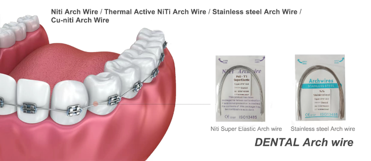 Buy China Wholesale Orthodontic Material Niti Wire Upper And Lower ...