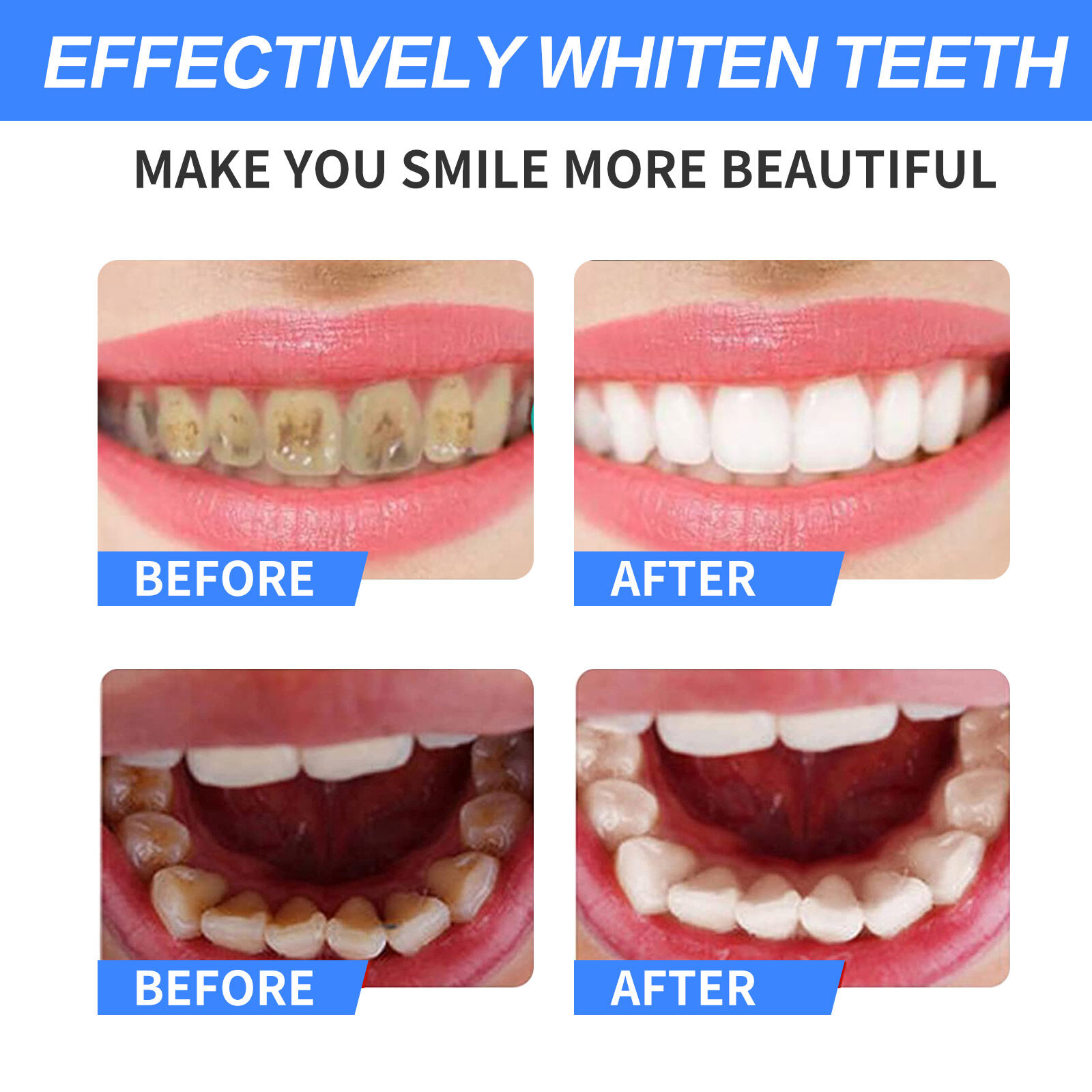 Buy Wholesale China Oem Obm Sefudun Toothpaste Intense Stain Whitening ...