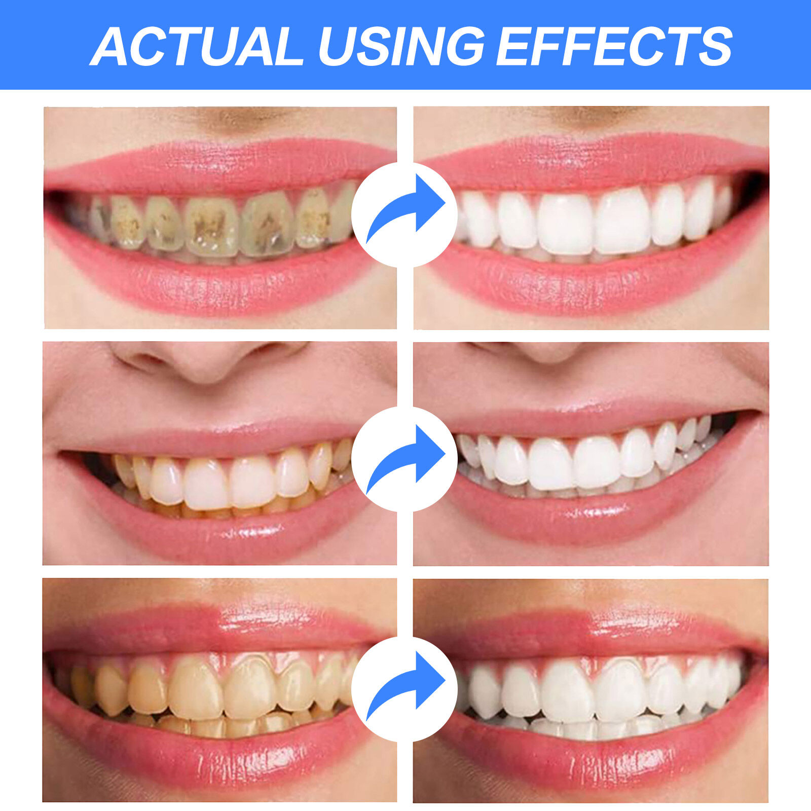 Buy Wholesale China Oem Obm Sefudun Toothpaste Intense Stain Whitening ...