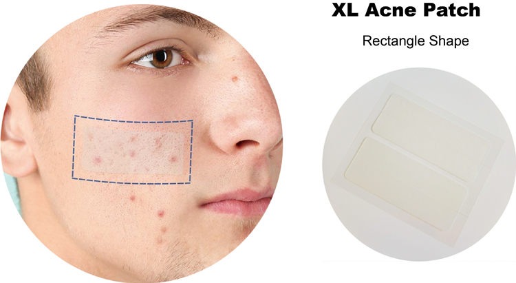 Buy Standard Quality China Wholesale Trummed Hydro Seal Acne Patches ...