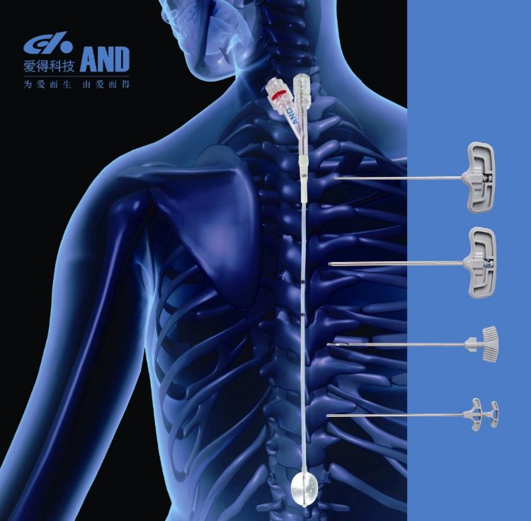 Bulk Buy China Wholesale Minimally Invasive Surgery Kyphoplasty Ballon ...