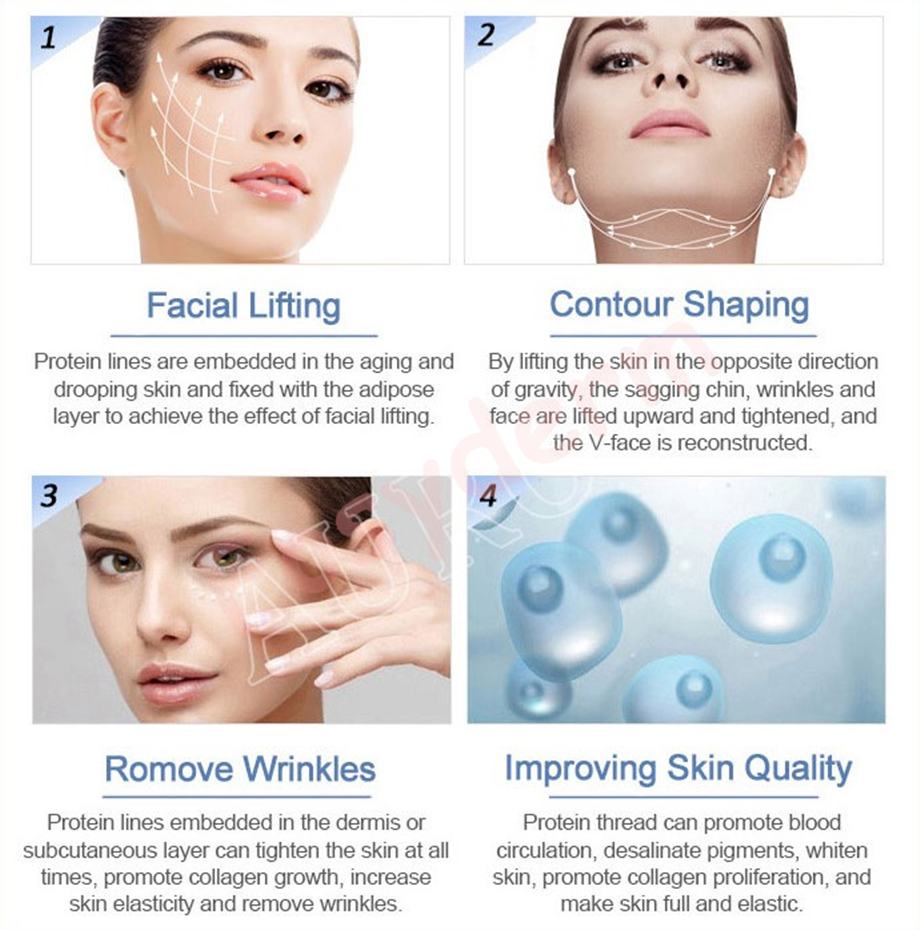 Buy Wholesale China Pdo Threads Lift Smooth Threads Hilos Pdo Mono ...