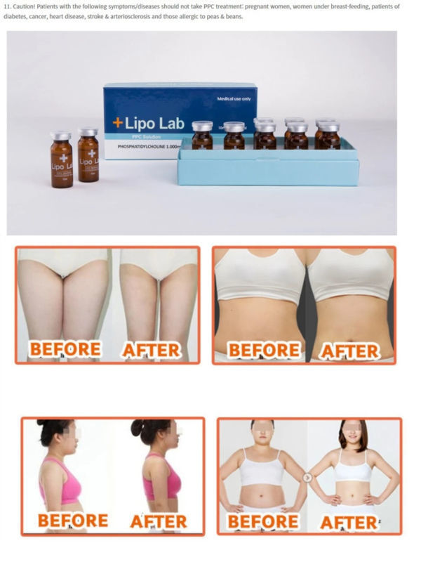 Buy Wholesale China Lipo Ppc Lipolytic Solution Injec Lipo-lab Lipolab Fat Solution Lipolytic ...