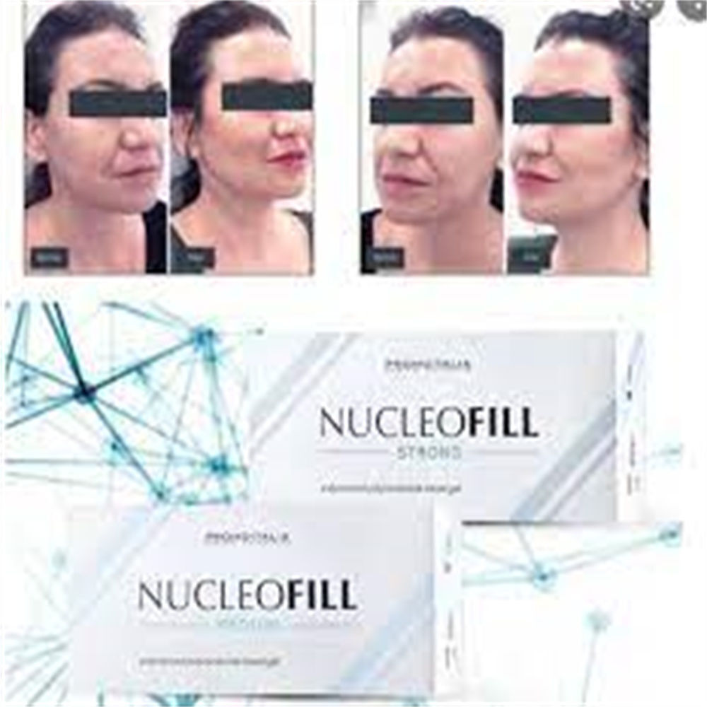 Buy Wholesale China 2023bio-revitalization Nucleofill Strong 7point ...