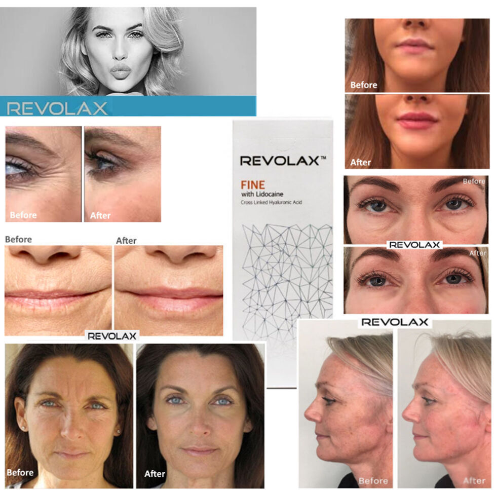 Buy Wholesale China Wholesale Revolax' Deep Wrinkle Removal Revolaxes ...