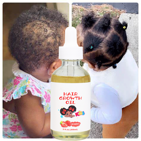 Baby Hair Growth Nature Organic Oil Nourishing Hair Care Custom Logo Hair Regrowth Oil Applicator Bottle China Wholesale Hair Growth Oil For Black Women Private Label Hair 2 from Guangzhou Xianghong