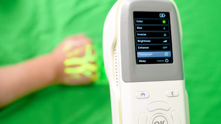 Vein Finder Machine Infrared Accu Vein Finder Price Table Stand Vein ...