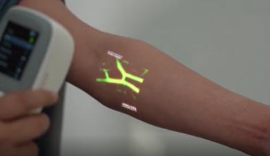 Vein Finder Machine Infrared Accu Vein Finder Price Table Stand Vein ...