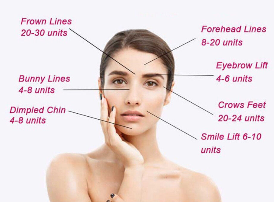 Buy Wholesale China Allergan Botoxs Botulinums 100iu Anti Wrinkles ...
