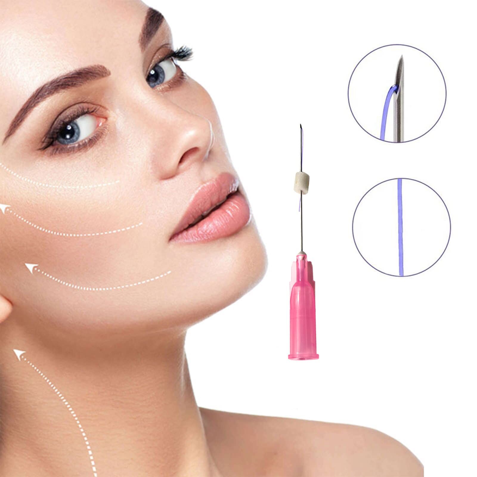 Buy Wholesale China Minerva Collagen Thread Lifting Tornado Mono 26g ...