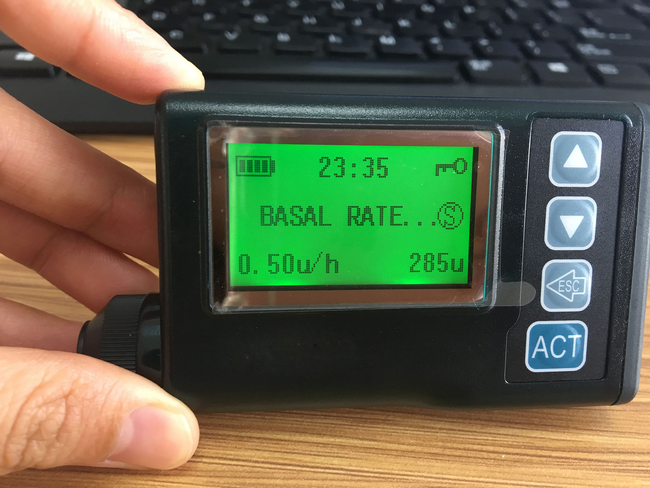 Portable Smart Diabetic Treatment Patient Insulin Pump, Insulin Pump ...