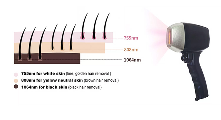 4k Screen Laser Hair Removal Diode Laser 3 Wavelengths 755 808 1064 ...