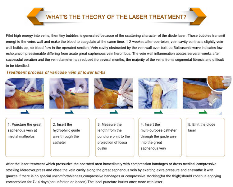 Varicose Veins Laser Treatment Machine 980nm 1470nm Diode Laser For ...